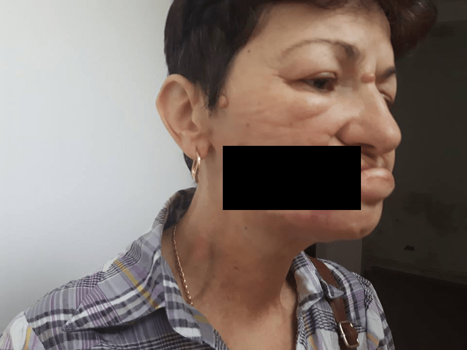 Femeia care vrea să-și reconstruiască fața și să învingă cancerul ...